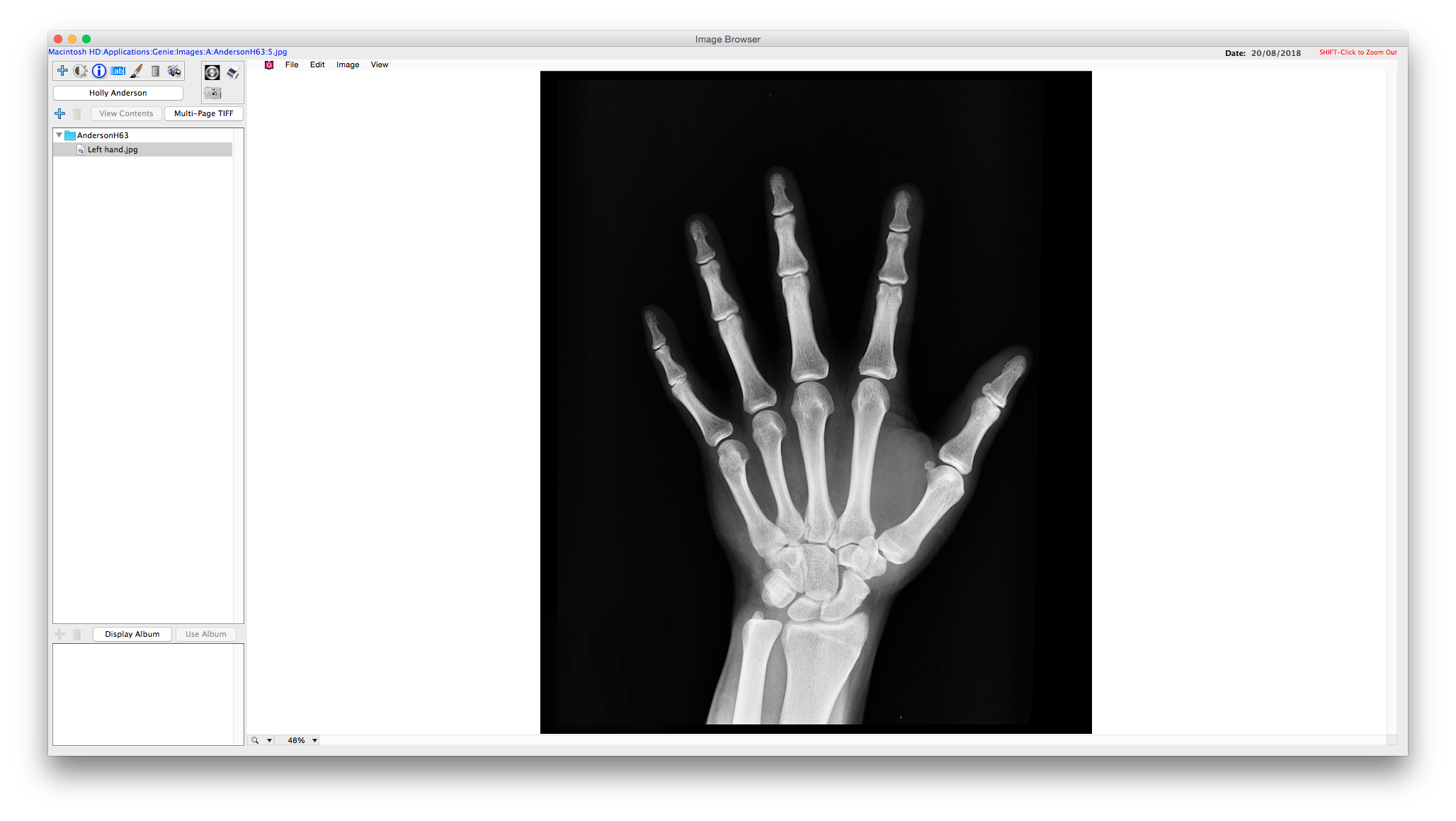 Advanced Scanning, Attachments, and Images | Genie Support