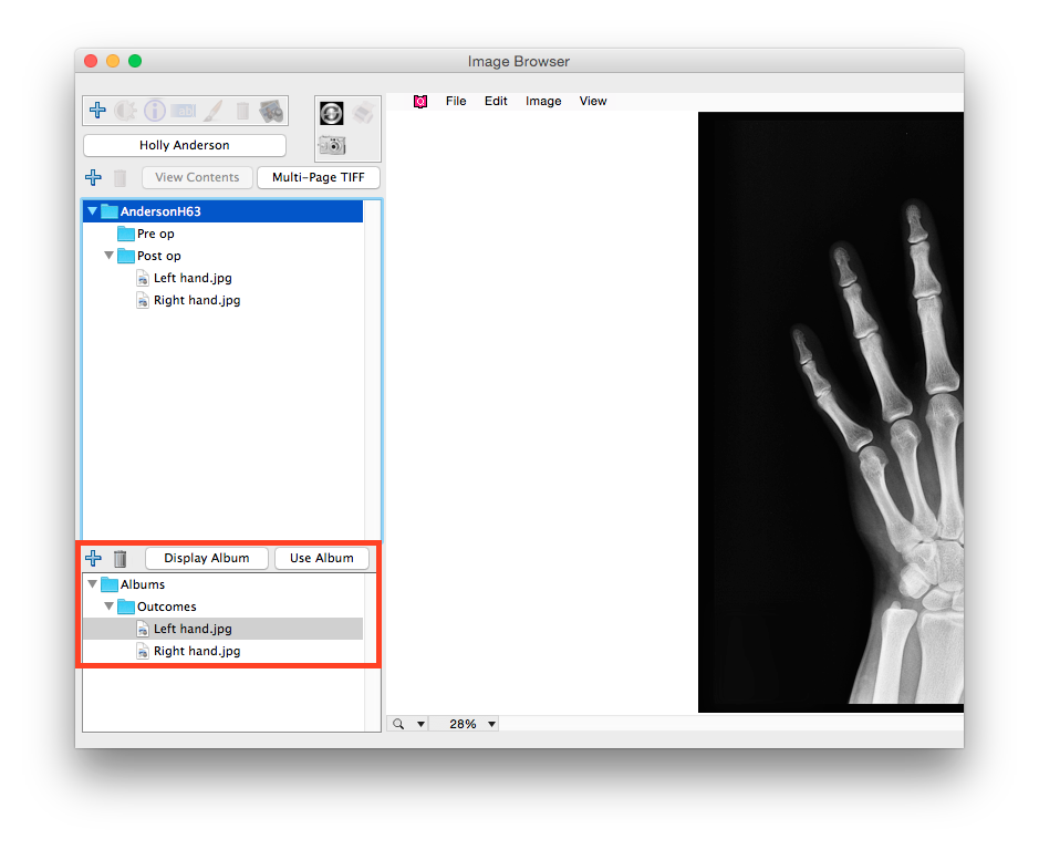 Advanced Scanning, Attachments, and Images | Genie Support