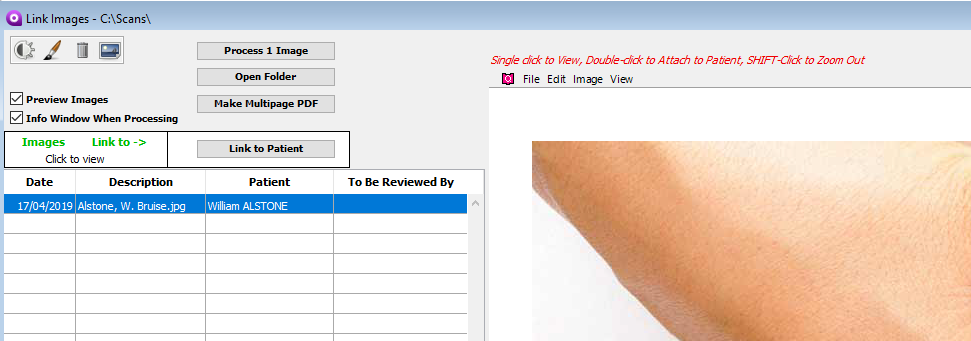 Scans for Review | Genie Support