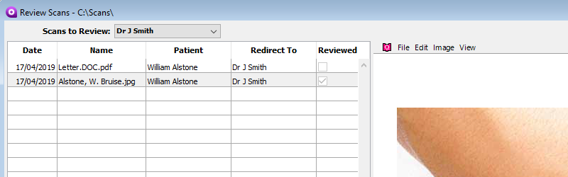 Scans for Review | Genie Support